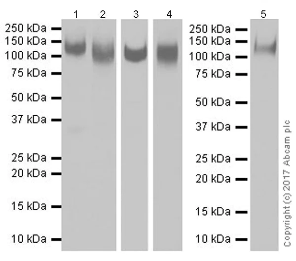 Anti-CD68 antibody [EPR20545] - macrophage marker (ab213363) | Abcam