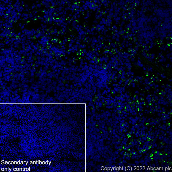 Anti-CD68 antibody [RM1031] - macrophage marker (ab303565) | Abcam