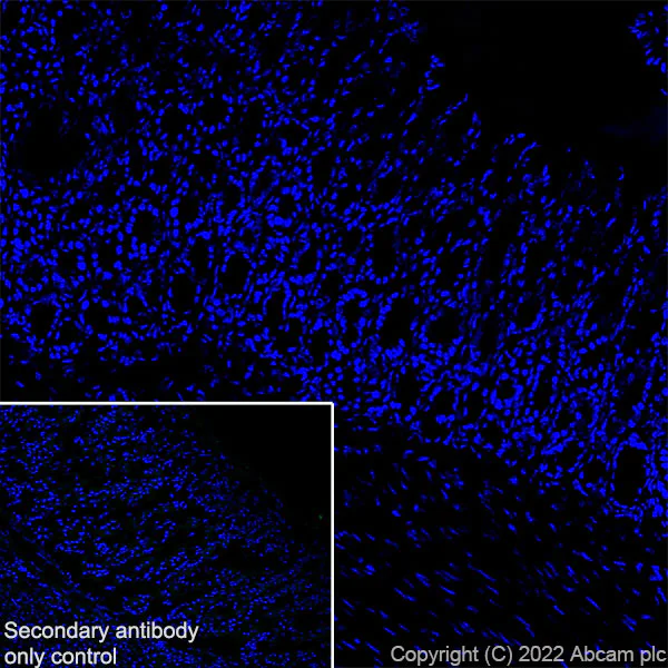 Anti-CD69 antibody [EPR25398-81] (ab307081) | Abcam