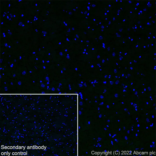 Anti-CD69 antibody [EPR25398-81] (ab307081) | Abcam