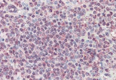 Anti-CD70 antibody (ab133398) | Abcam