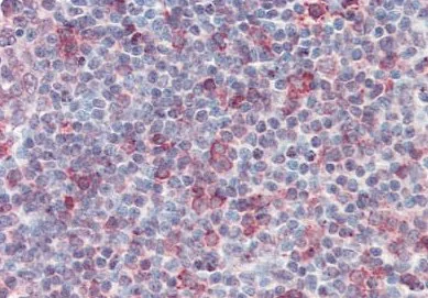 Anti-CD70 antibody (ab133398) | Abcam