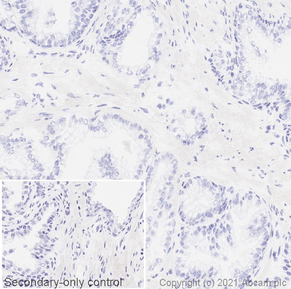 Anti-CD70 antibody [BU69] (ab77868) | Abcam