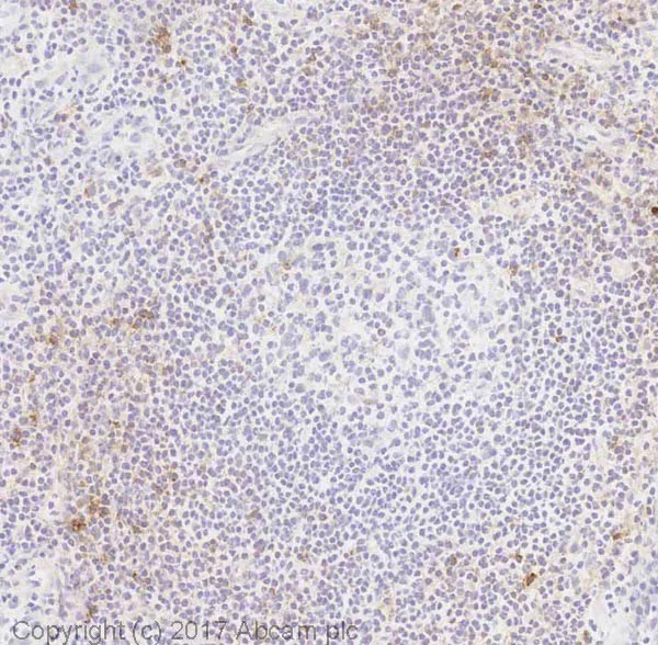 Anti-CD70 antibody [BU69] (ab77868) | Abcam