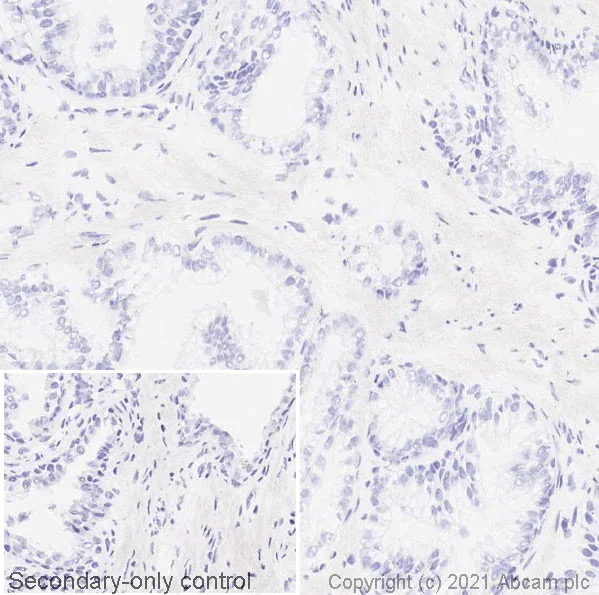Anti-CD70 antibody [BU69] - BSA and Azide free (ab269573) | Abcam