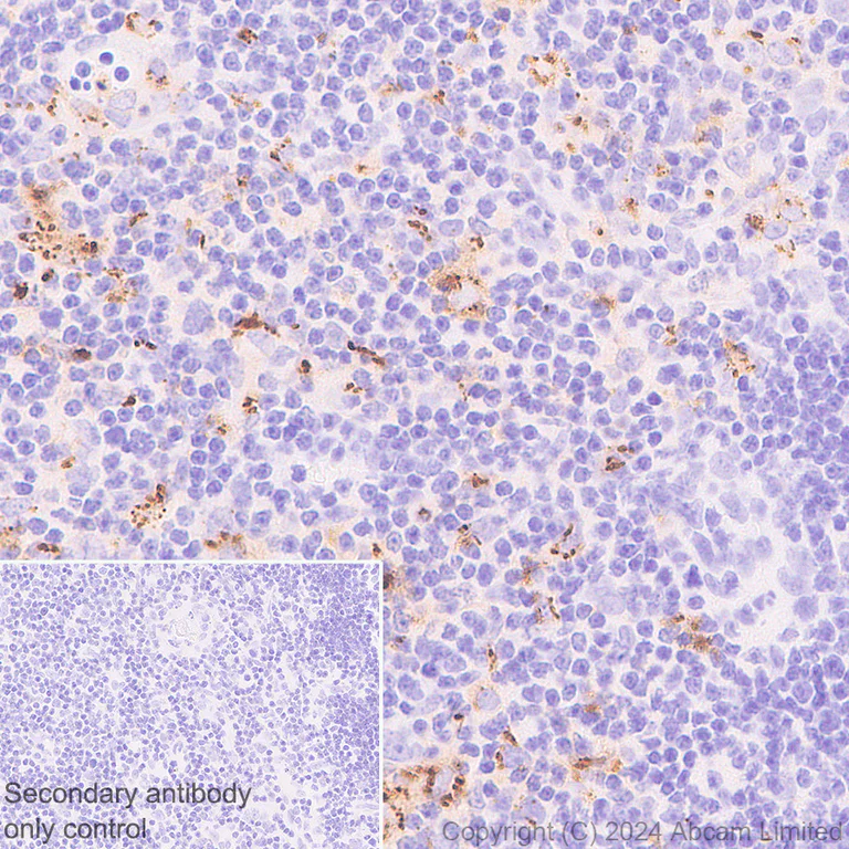 Anti-CD70 antibody [EPR28771-94] (ab319990) | Abcam