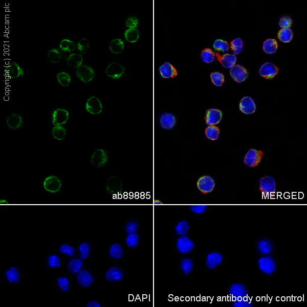 Anti-CD74 antibody [EPR25399-94] (ab289885) | Abcam