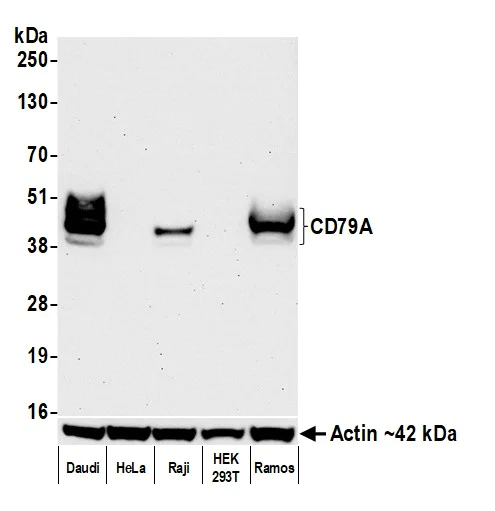 Anti-CD79A antibody [BLR234K] - BSA free (ab314053) | Abcam