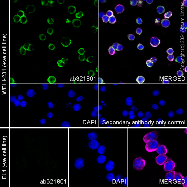 Anti-CD79a antibody [EPR29061-505] (ab321801) | Abcam