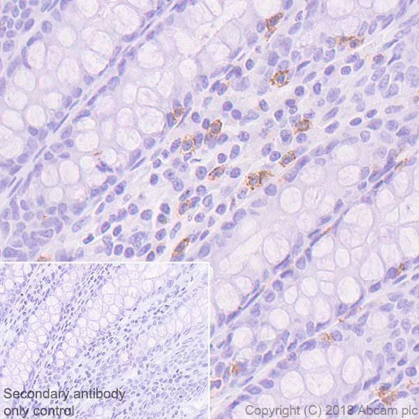 Anti-CD8 alpha antibody [EPR22483-288] (ab245118) | Abcam