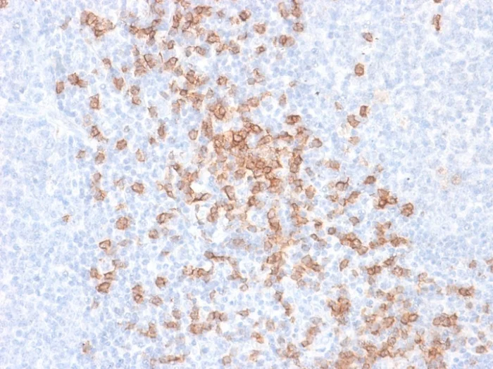 Anti-CD8 alpha antibody [rC8/468] - BSA and Azide free (ab238087) | Abcam