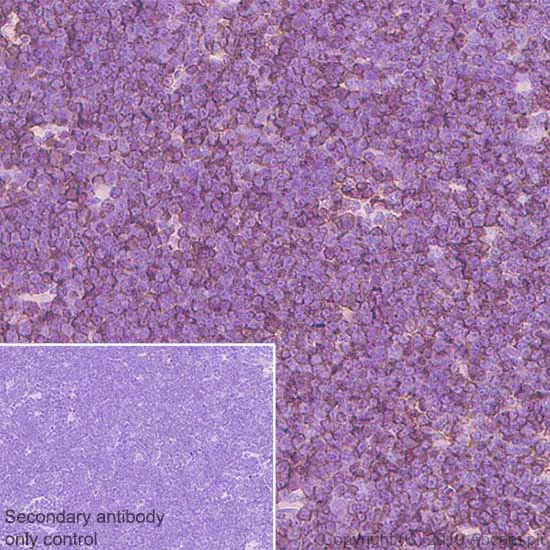 Anti-CD8 beta antibody [EPR22331-54] Rabbit monoclonal (ab228965) | Abcam