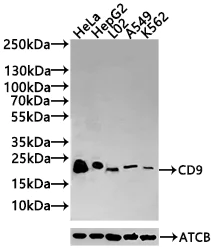 Anti-CD9 antibody - monocyte marker (ab223052) | Abcam