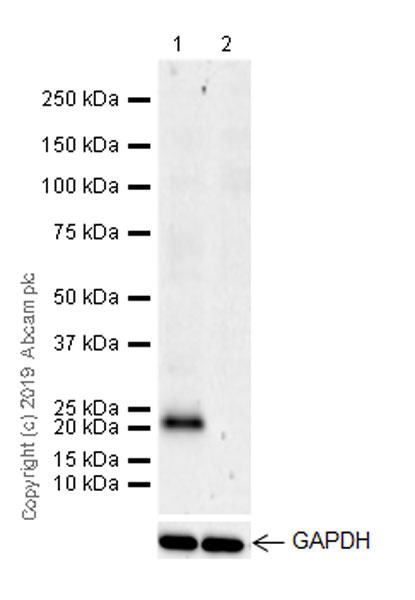 Anti-CD9 antibody [EPR23105-121] - monocyte marker (ab236630) | Abcam