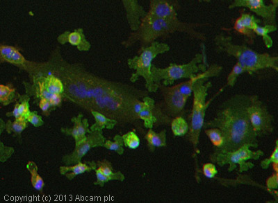 Anti-CD97 antibody [EPR4427] (ab108368) | Abcam