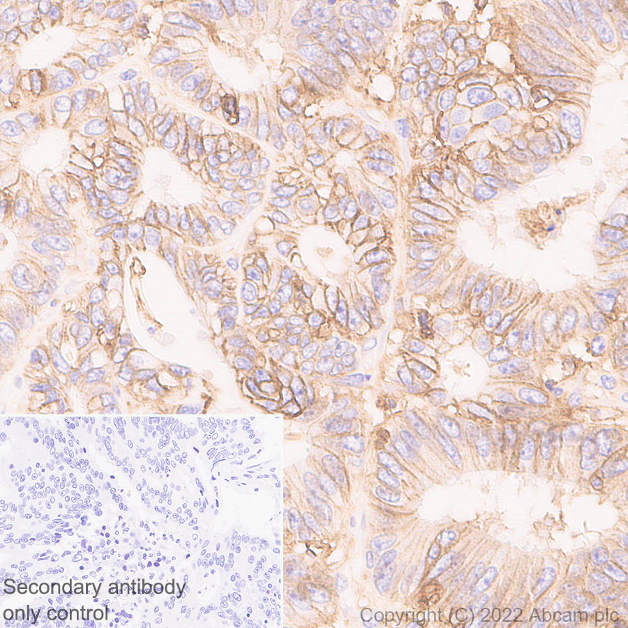 Muscarinic Acetylcholine Receptor 1/CHRM1抗体 (ab77098)| Abcam中文官网