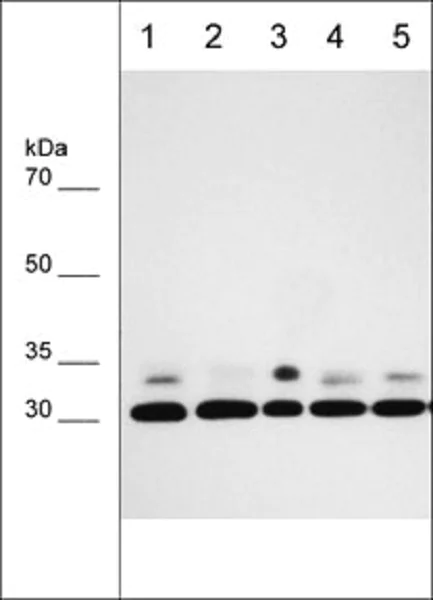 CD99抗体[M026] - Extracellular domain (ab253291)| Abcam中文官网