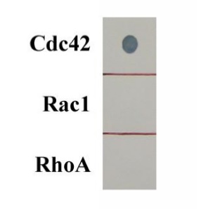 Cdc42 Activation Assay Kit (ab211163) | Abcam