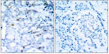 Anti-CDK1 (phospho T161) antibody (ab47329) | Abcam
