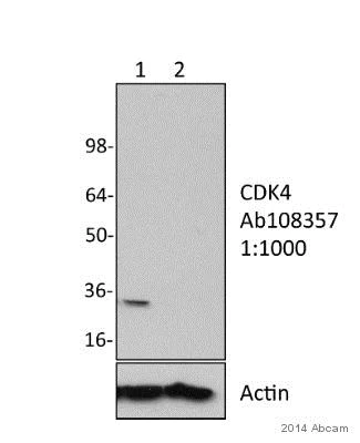 Anti-Cdk4 antibody [EPR4513-32-7] (ab108357) | Abcam