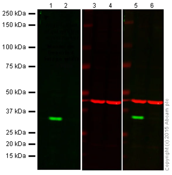 Anti-Cdk4 antibody [EPR4513-32-7] (ab108357) | Abcam