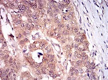 CDKN2A/p16INK4a抗体[1D7D2A1] (ab201980)| Abcam中文官网