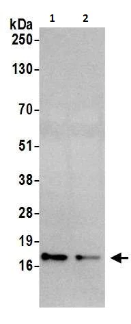 Anti-CDKN2A/p16INK4a antibody (ab264192) | Abcam