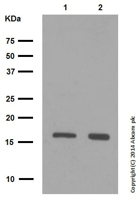 Anti-CDKN2A/p16INK4a antibody - C-terminal [EPR1473] (ab108349) | Abcam