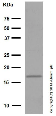 Anti-CDKN2A/p16INK4a antibody - C-terminal [EPR1473] (ab108349) | Abcam