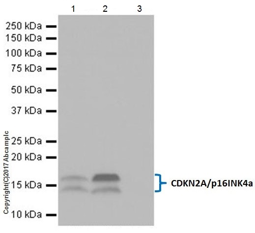 Anti-p16 antibody [EPR20418], recombinant (ab211542) | Abcam