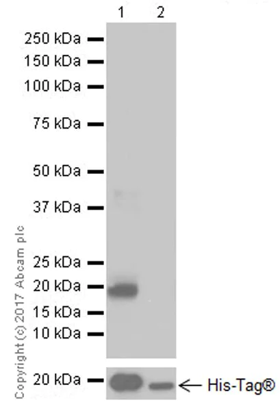 Anti-CDKN2A/p16INK4a antibody [EPR20418], recombinant (ab211542) | Abcam