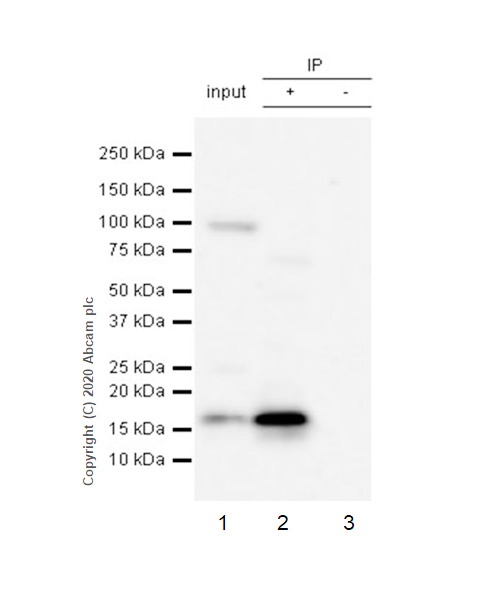 Anti-CDKN2A/p16INK4a antibody [EPR20418], recombinant (ab211542) | Abcam