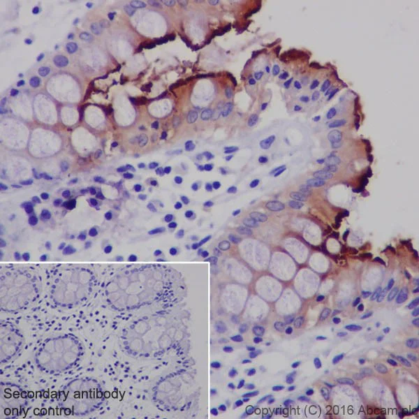 Anti-CEACAM1 + CEACAM6 antibody [EPR19878] (ab206431) | Abcam
