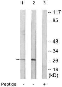 Anti-CEBP Delta/CEBPD antibody (ab65081) | Abcam