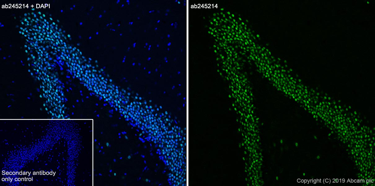 Anti-CEBP Delta/CEBPD antibody [EPR23518-259] (ab245214) | Abcam