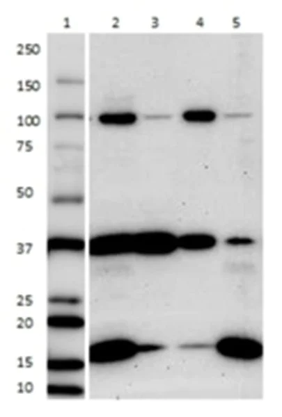 Cell fractionation kit - standard (ab109719) | Abcam