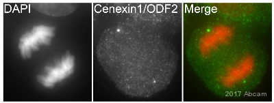 Anti-Cenexin1/ODF2 antibody (ab43840) | Abcam