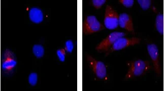 Anti-Centrin 1 antibody (ab156858) | Abcam