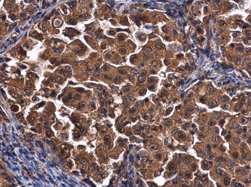 Anti-CEP192 antibody - C-terminal (ab229705) | Abcam