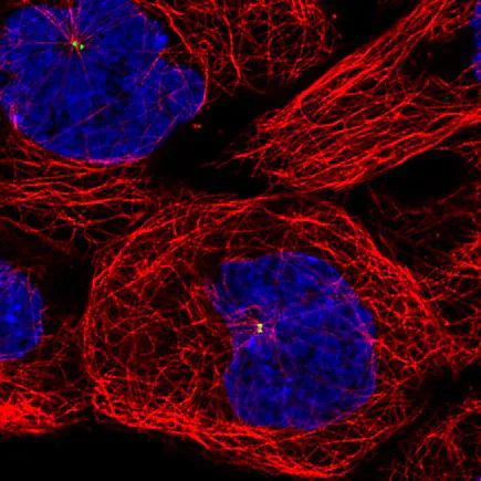 Anti-CEP350 antibody [CL3423] (ab219831) | Abcam