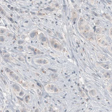 Anti-CEP350 antibody [CL3423] (ab219831) | Abcam