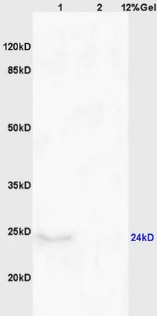 Anti-CHAC1 antibody (ab217808) | Abcam