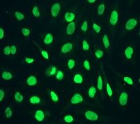 Anti-CHD3 antibody [EPNCIR110A] (ab109195) | Abcam