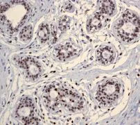 Anti-CHD3 antibody [EPNCIR110A] - BSA and Azide free (ab240942) | Abcam