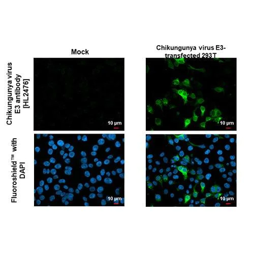 Anti-Chikungunya virus E3 antibody [HL2476] (ab317233) | Abcam中文官网