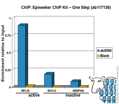 ChIP Kit - One Step (ab117138) | Abcam