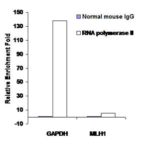 ChIP Kit - One Step (ab117138) | Abcam