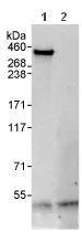Anti-Chromodomain helicase DNA binding protein 9 antibody (ab114115 ...