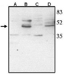 Anti-CHX10 antibody. Sheep polyclonal (ab16141) | Abcam