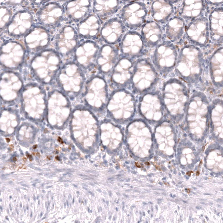 Anti-CLEC10A Antibody [CL15523] (ab327164) | Abcam中文官网